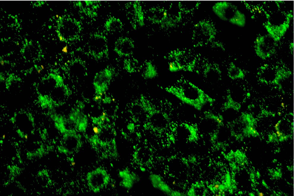 DiO plus细胞膜荧光探针绿色 – 美仑生物
