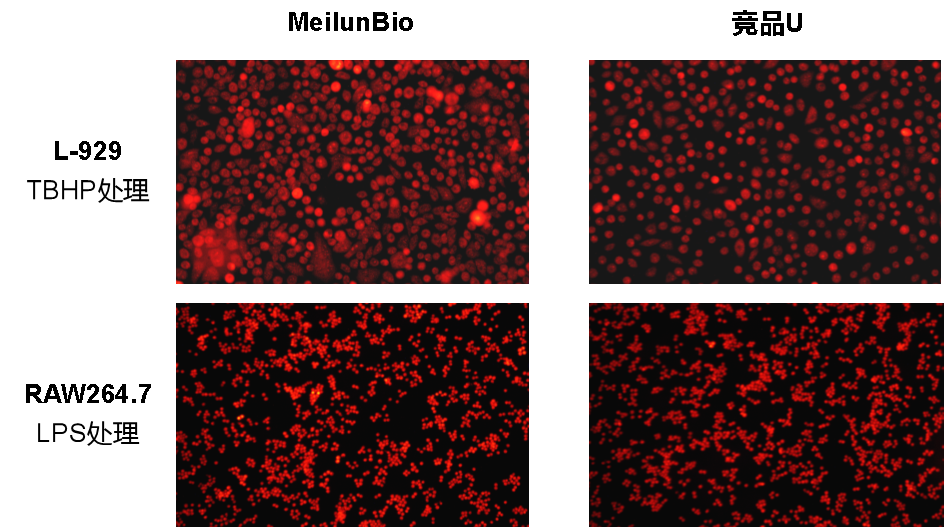 活性氧ROS检测溶液（DHE红色荧光探针） – 美仑生物