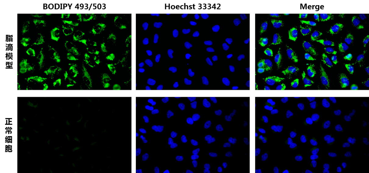 荧光法脂滴检测试剂盒(绿色,BODIPY 493/503) – 美仑生物